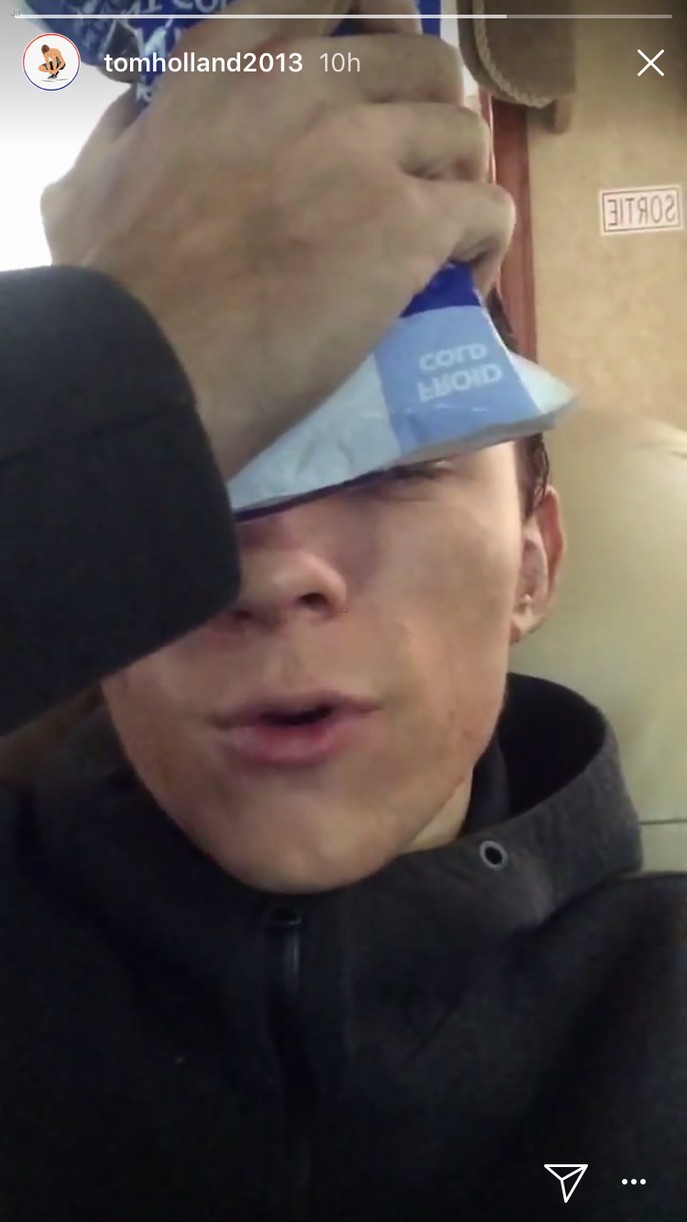 Tom Holland Broke His Nose Again While Wrapping New Movie 'Chaos ...