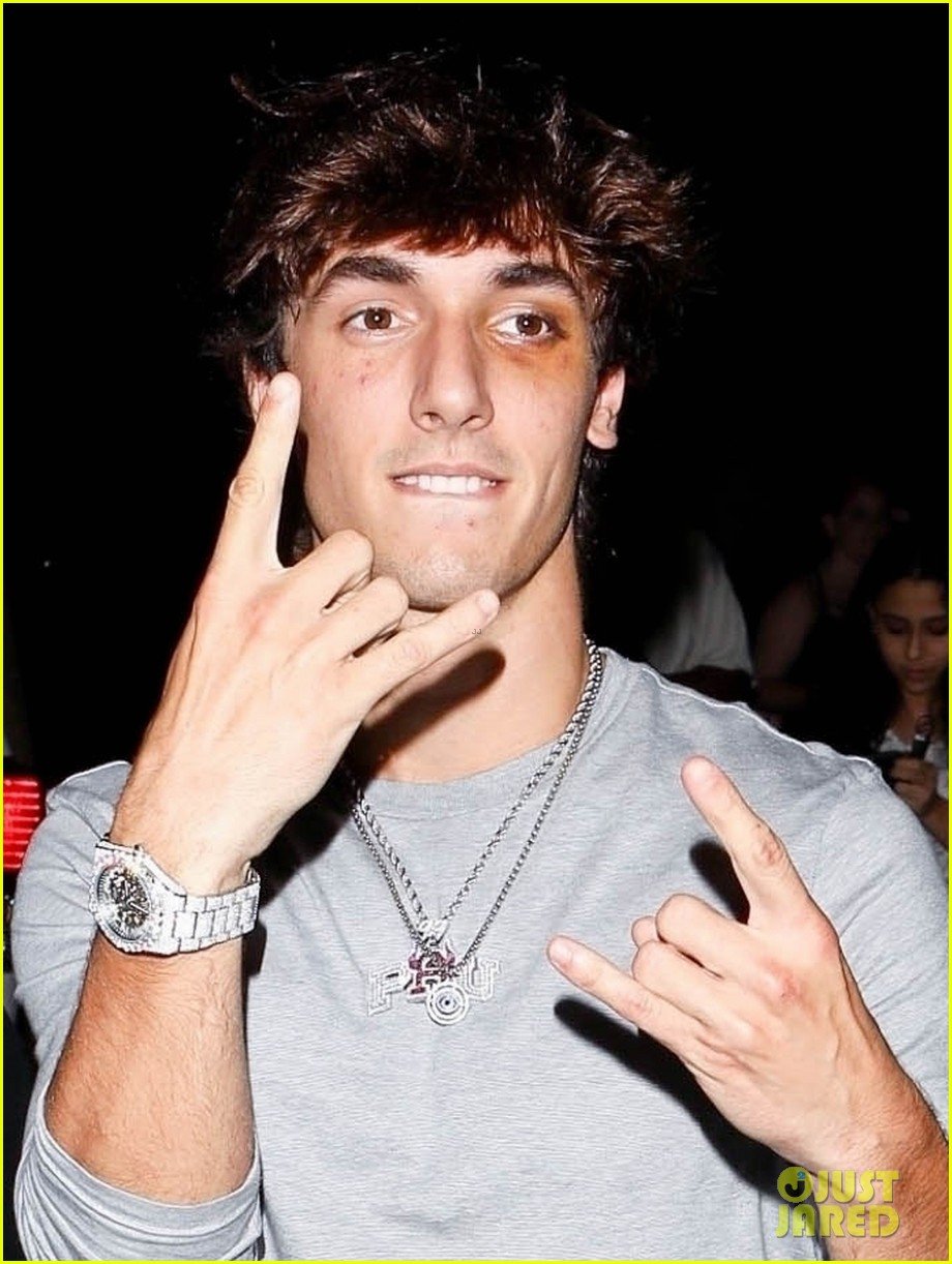 Bryce Hall Shows Off His Bruised Eye While Out With Friends After ...